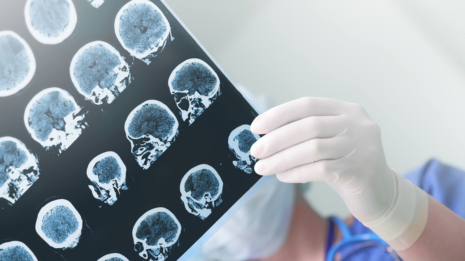 Stroke Treatment - Astera Health